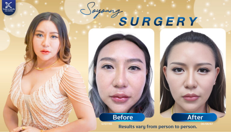 Jaw Reduction Surgery